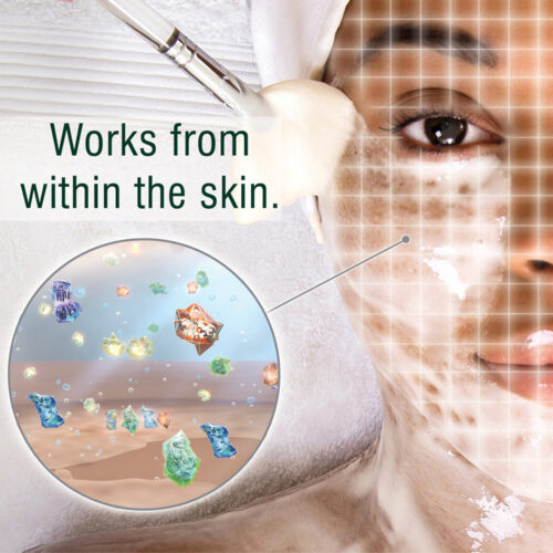 DMK Enzyme Therapy | Advanced Facial | 369 LC Birmingham